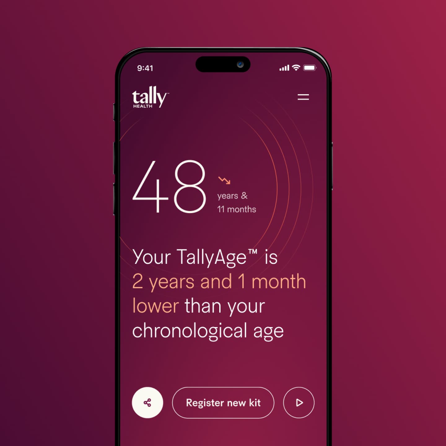 Tally Monthly Membership